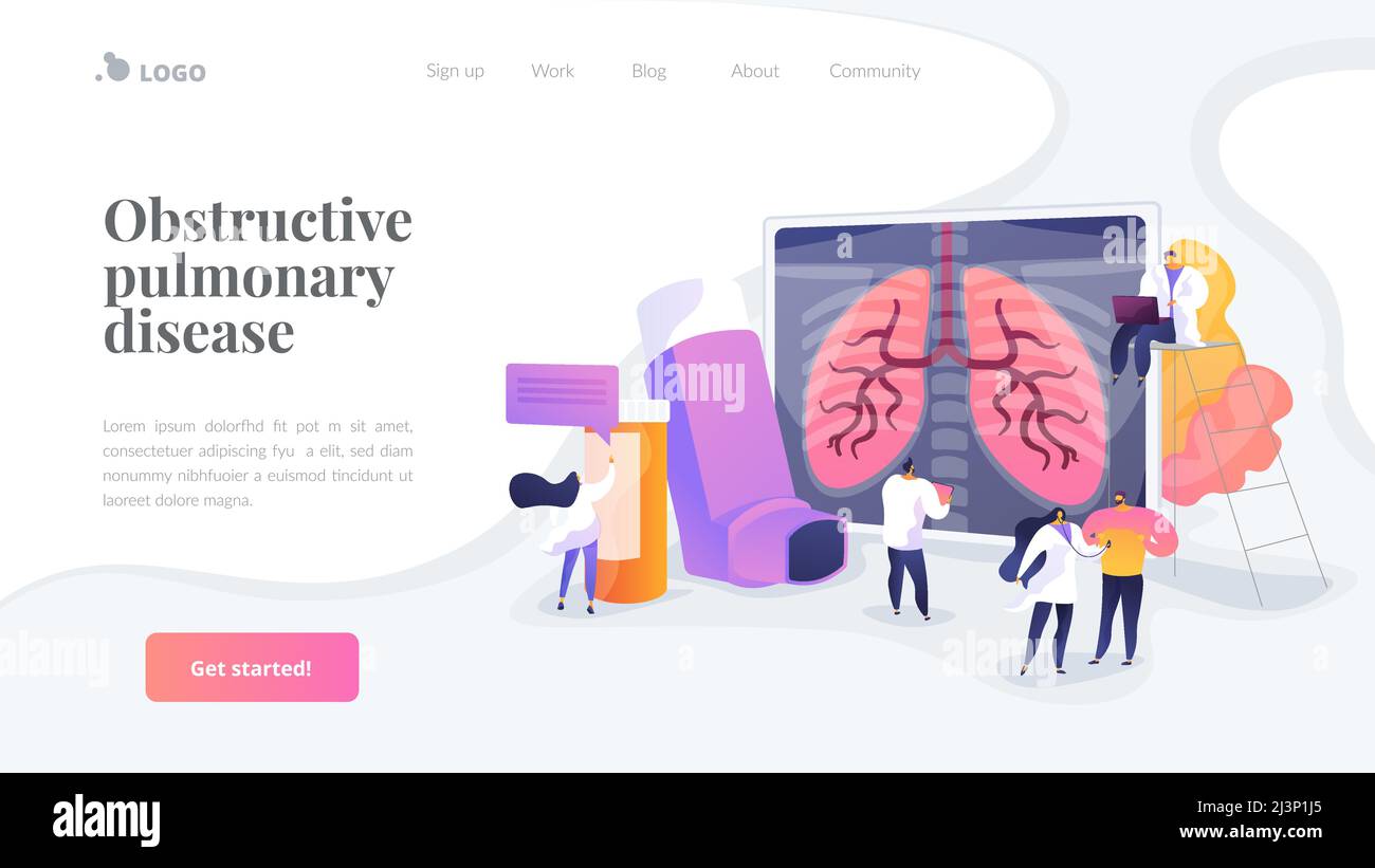 Chest x ray of patient with copd hi-res stock photography and images ...