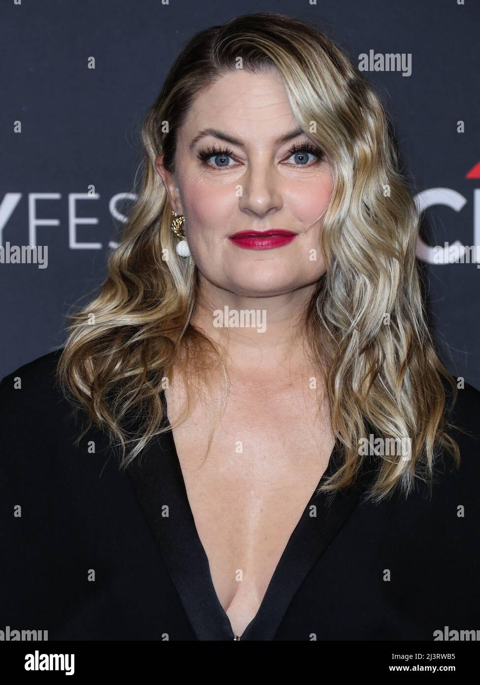 Madchen Amick Awful Plastic Surgery Where Are They Now? The Cast Of