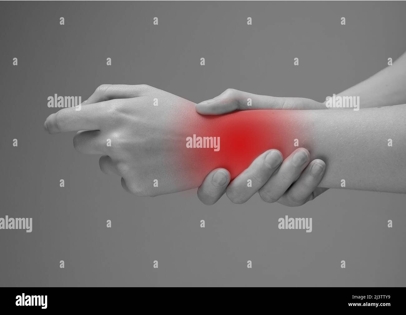 Carpal tunnel syndrome hi-res stock photography and images - Alamy