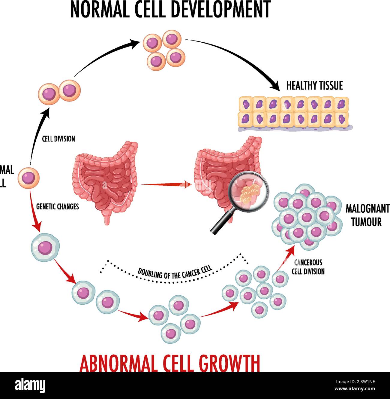 Cancer Development Diagram