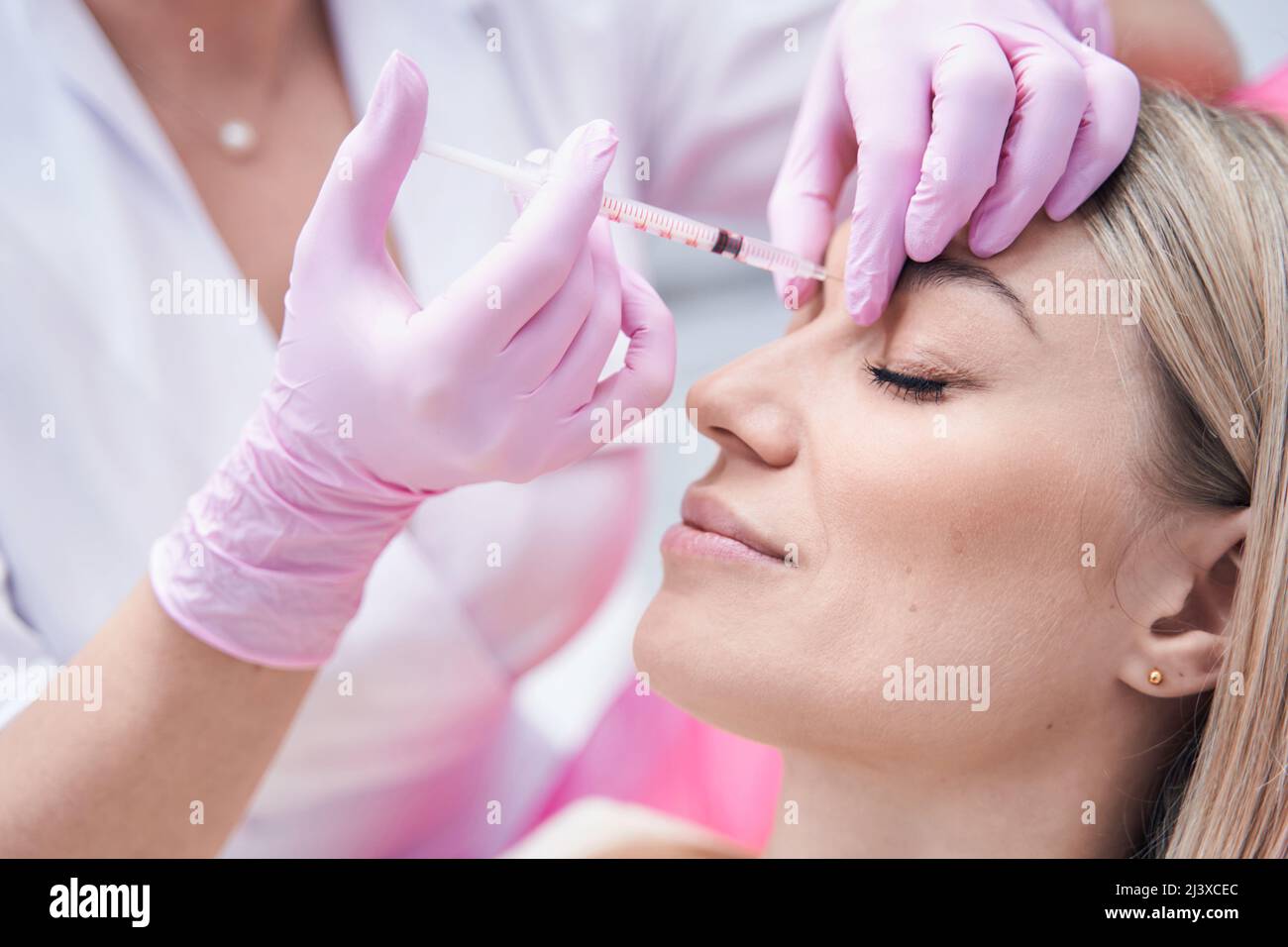 Female patient getting rid of frown wrinkles Stock Photo - Alamy