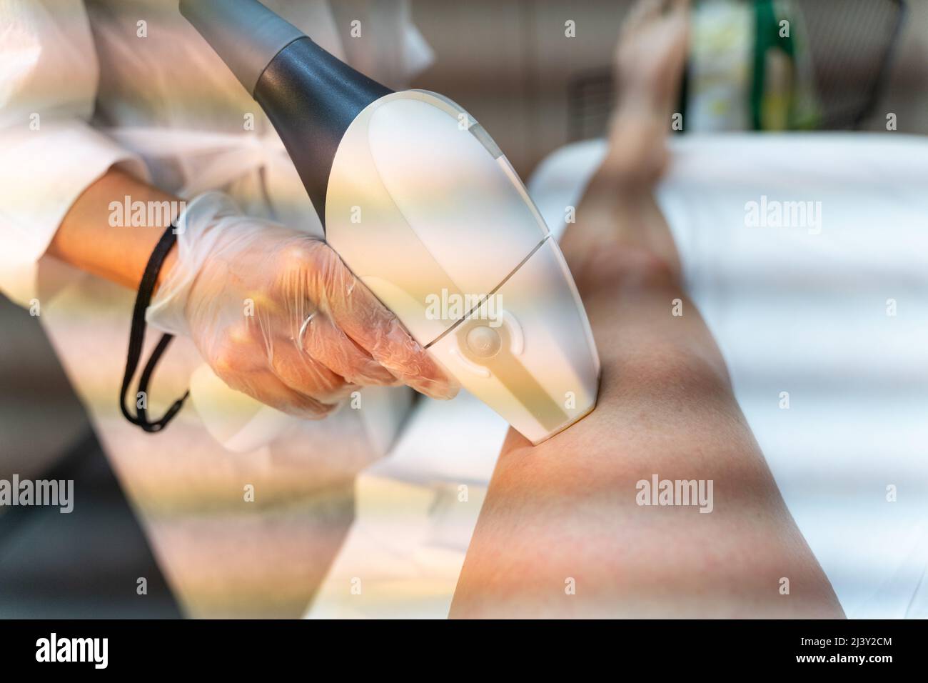 Laser hair removal machine on leg of man. Beauty treatment, beautician ...