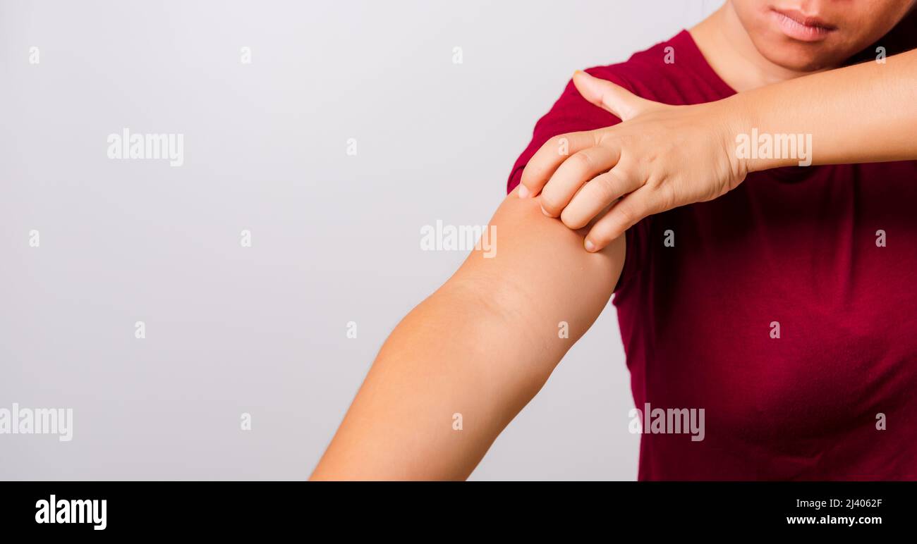 Asian beautiful woman itching her scratching her itchy arm on white ...