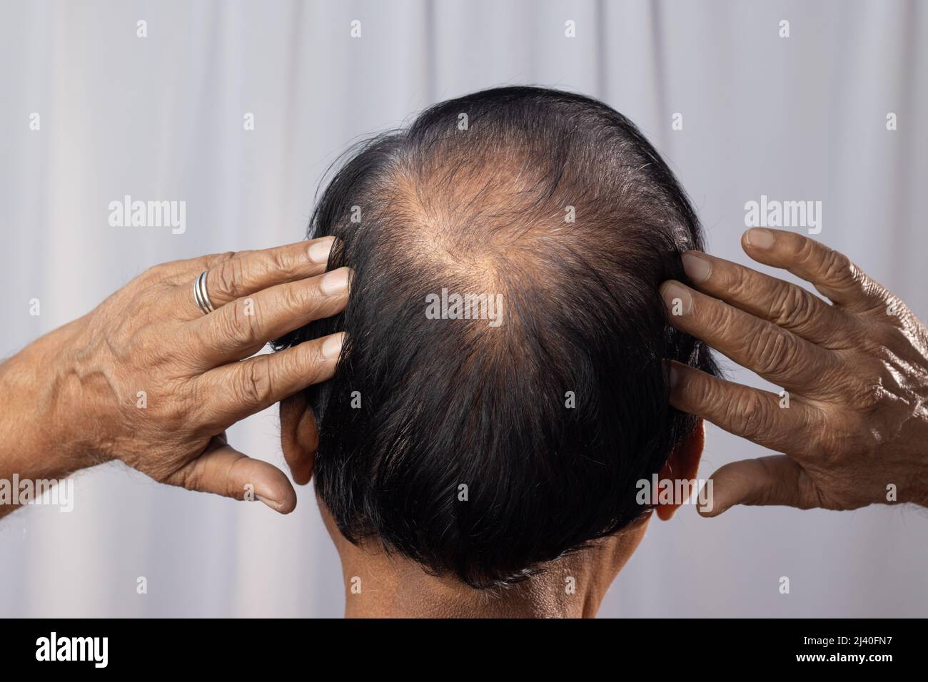 An aged Indian man showing his hair fall back facing on white ...