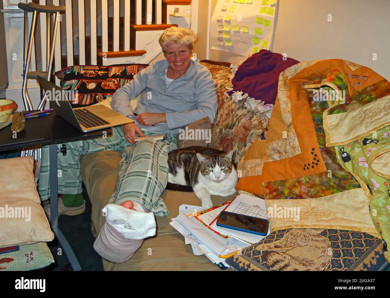 Woman leg cast crutches in hi-res stock photography and images - Alamy