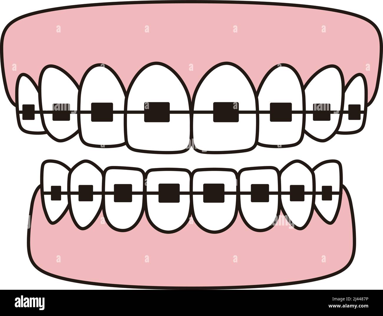 Teeth braces icons, Vector flat illustration Stock Vector Image & Art ...