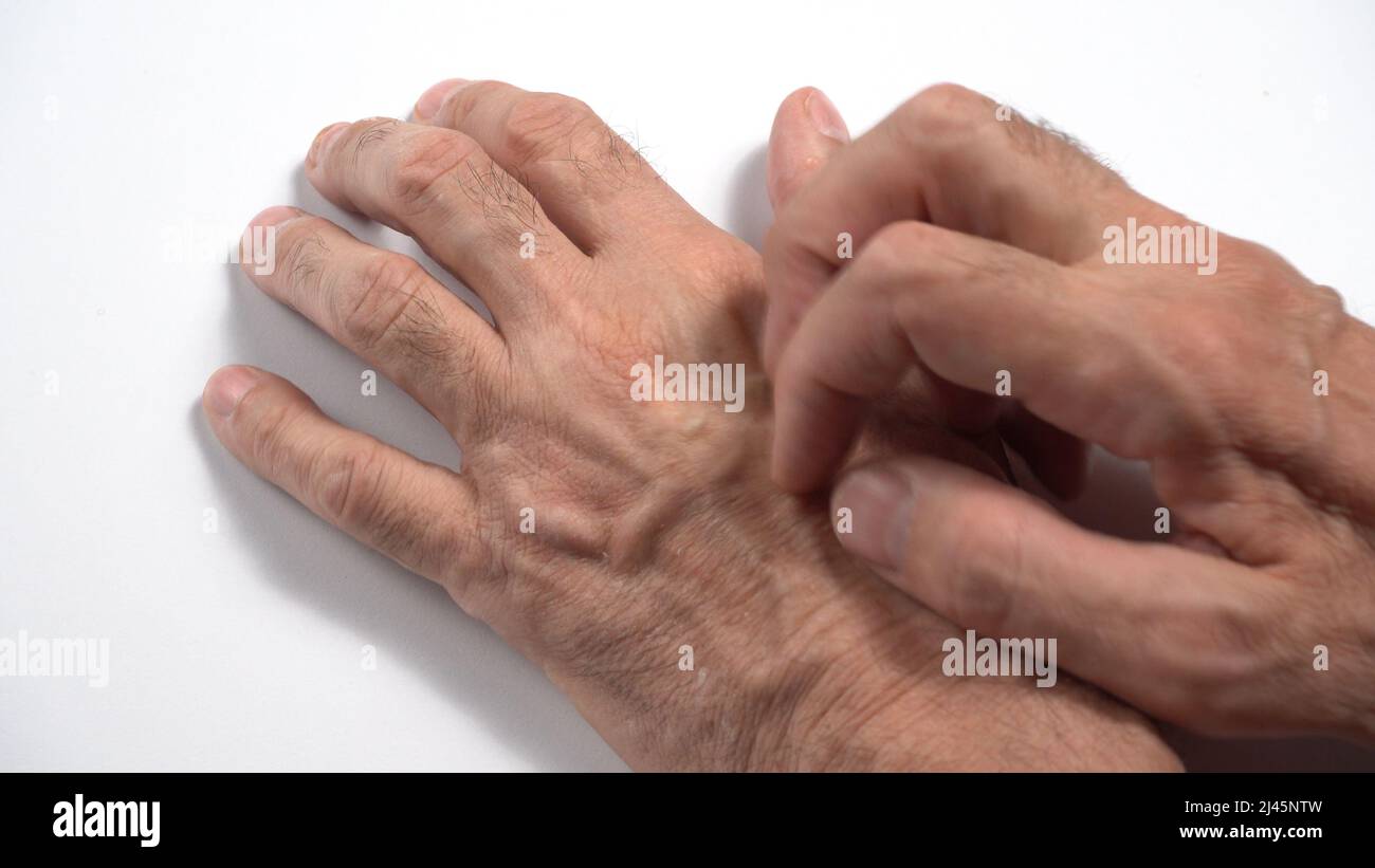 Peripheral nervous system hi-res stock photography and images - Alamy