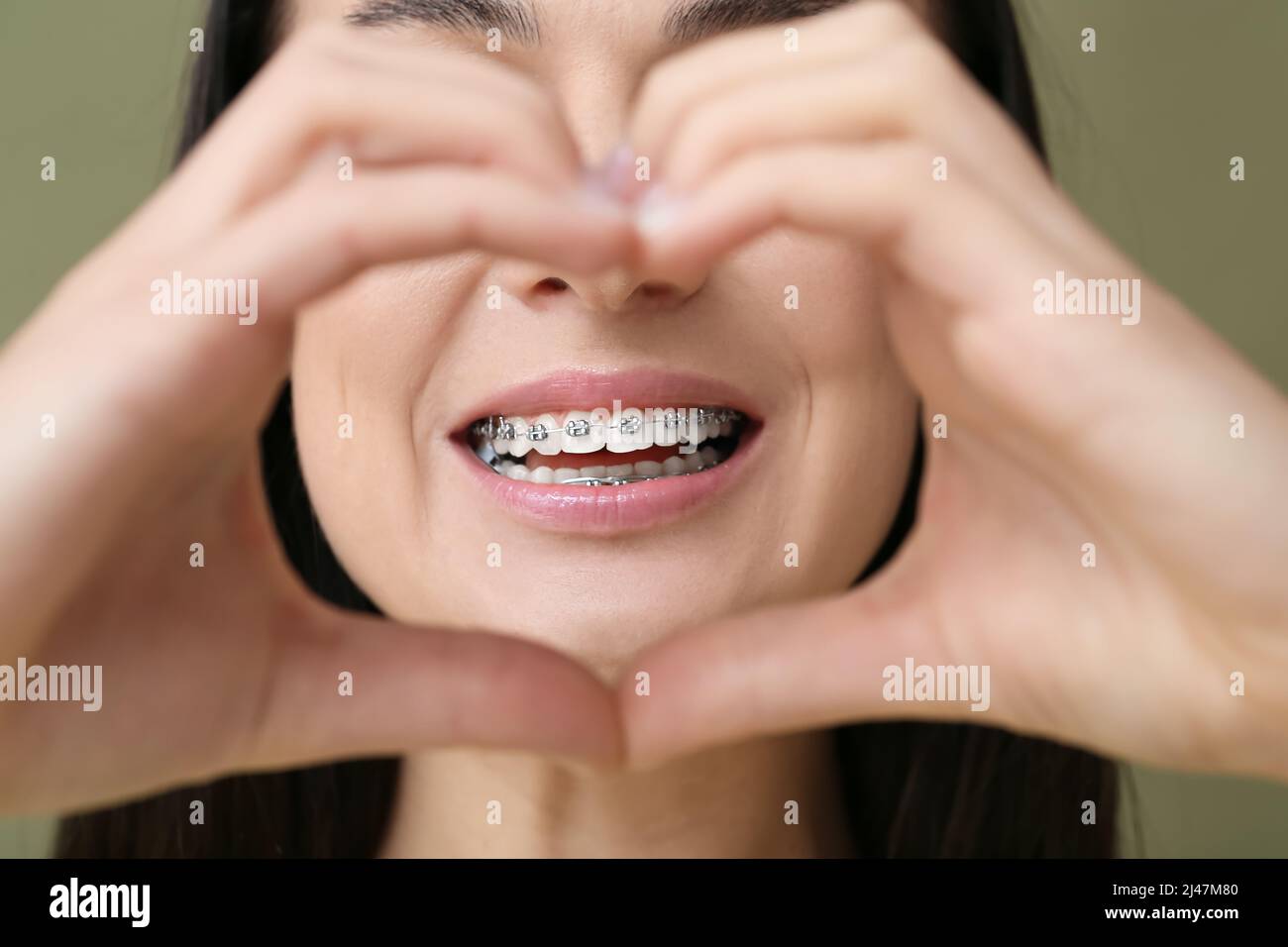Beautiful woman with dental braces making heart with her hands on color ...