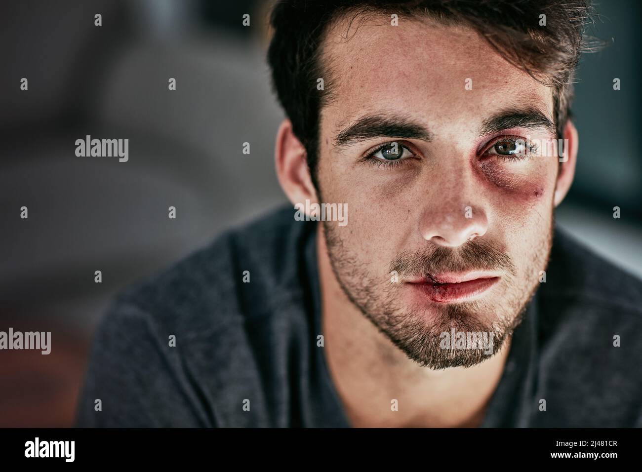 Fighting scratches hi-res stock photography and images - Alamy
