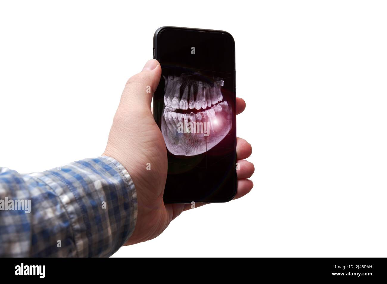 Man's hand holding a mobile phone with an x-ray image of his jaw and ...