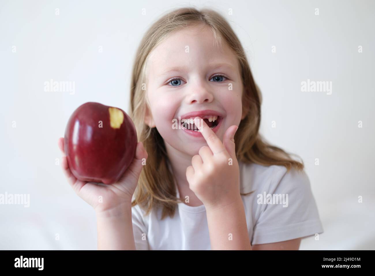 Girl without teeth smiling hi-res stock photography and images - Alamy