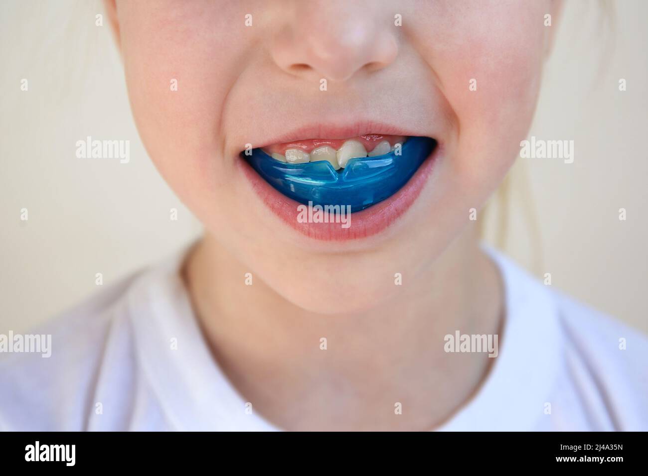 Dental simulator for teeth alignment . The child has mouth guards on ...