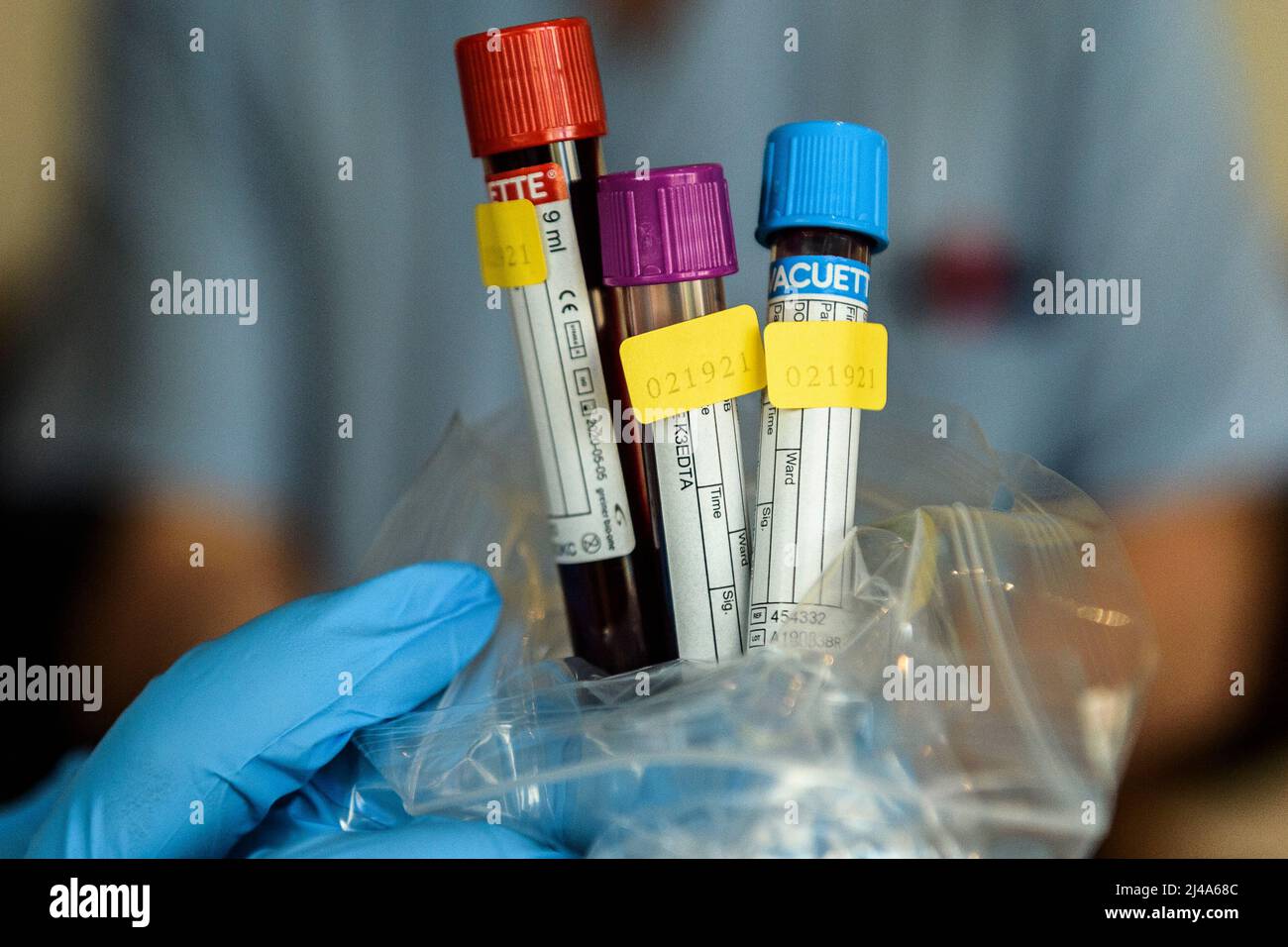 Blood sample, suspicion of Covid-19. Test tubes handled with caution ...