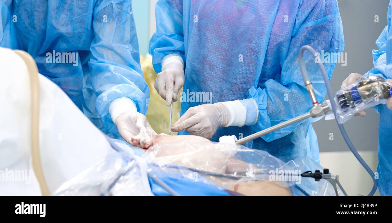A team of surgeons in a sterile blue uniform and white latex gloves ...