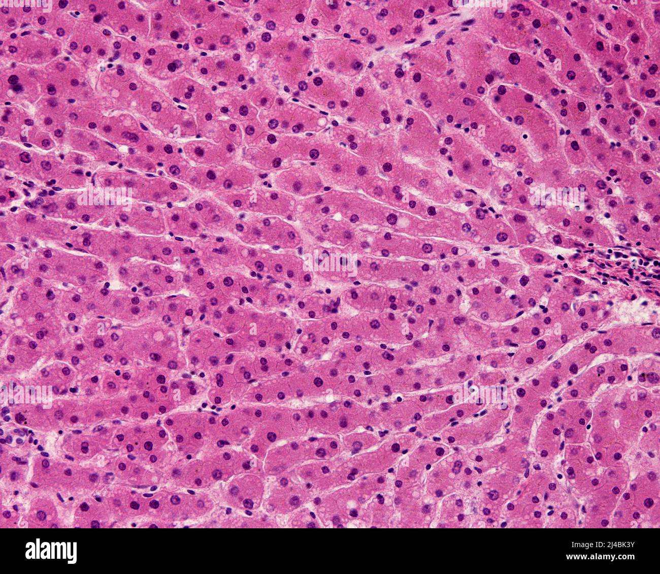 Human liver, light micrograph Stock Photo - Alamy