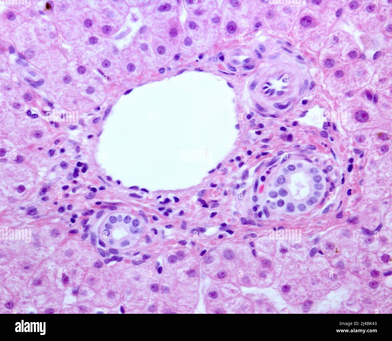 Portal area of human liver, light micrograph Stock Photo - Alamy
