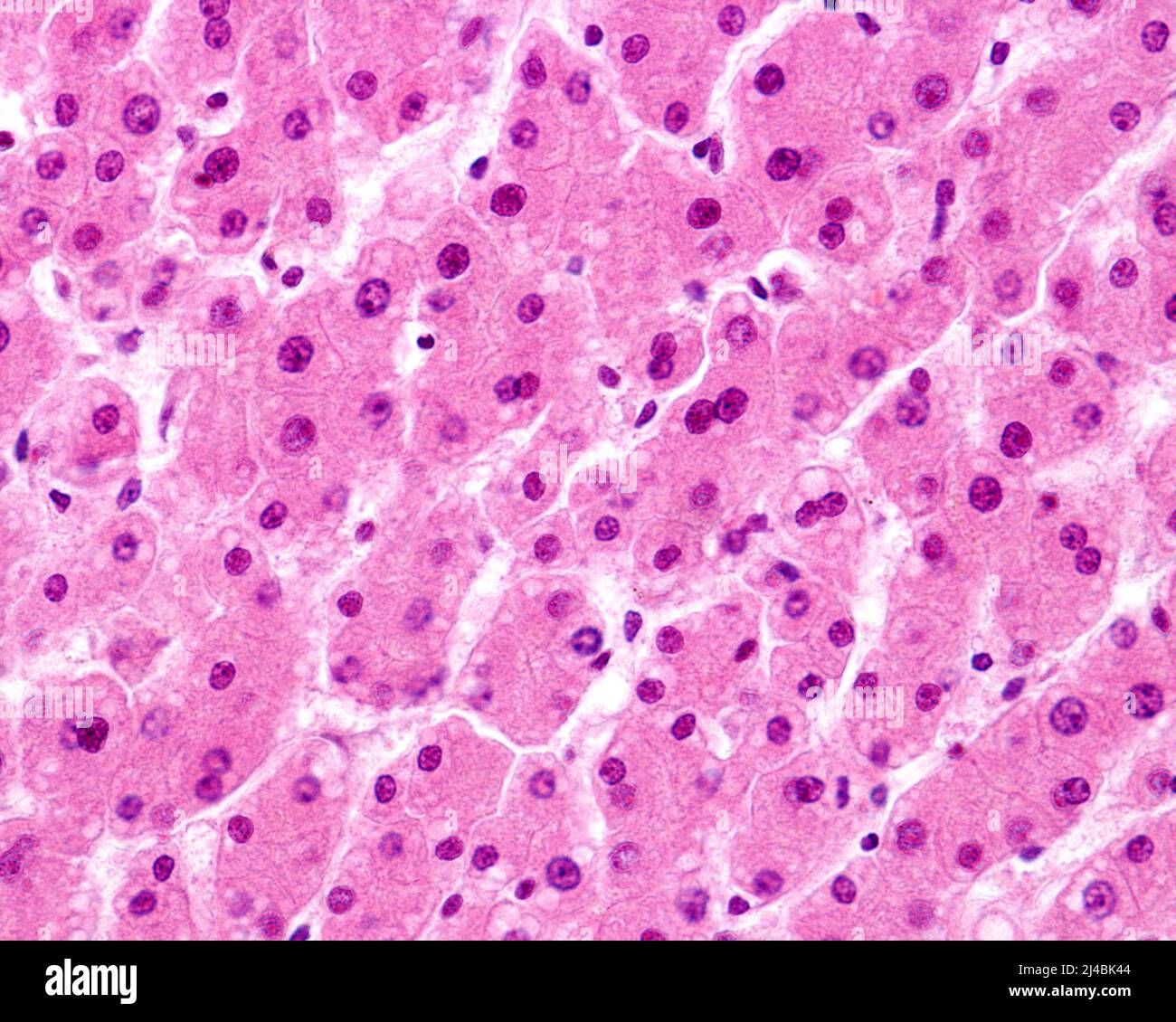 Human liver, light micrograph Stock Photo - Alamy