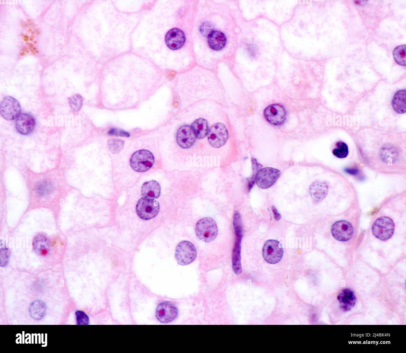 Liver cells, light micrograph Stock Photo - Alamy