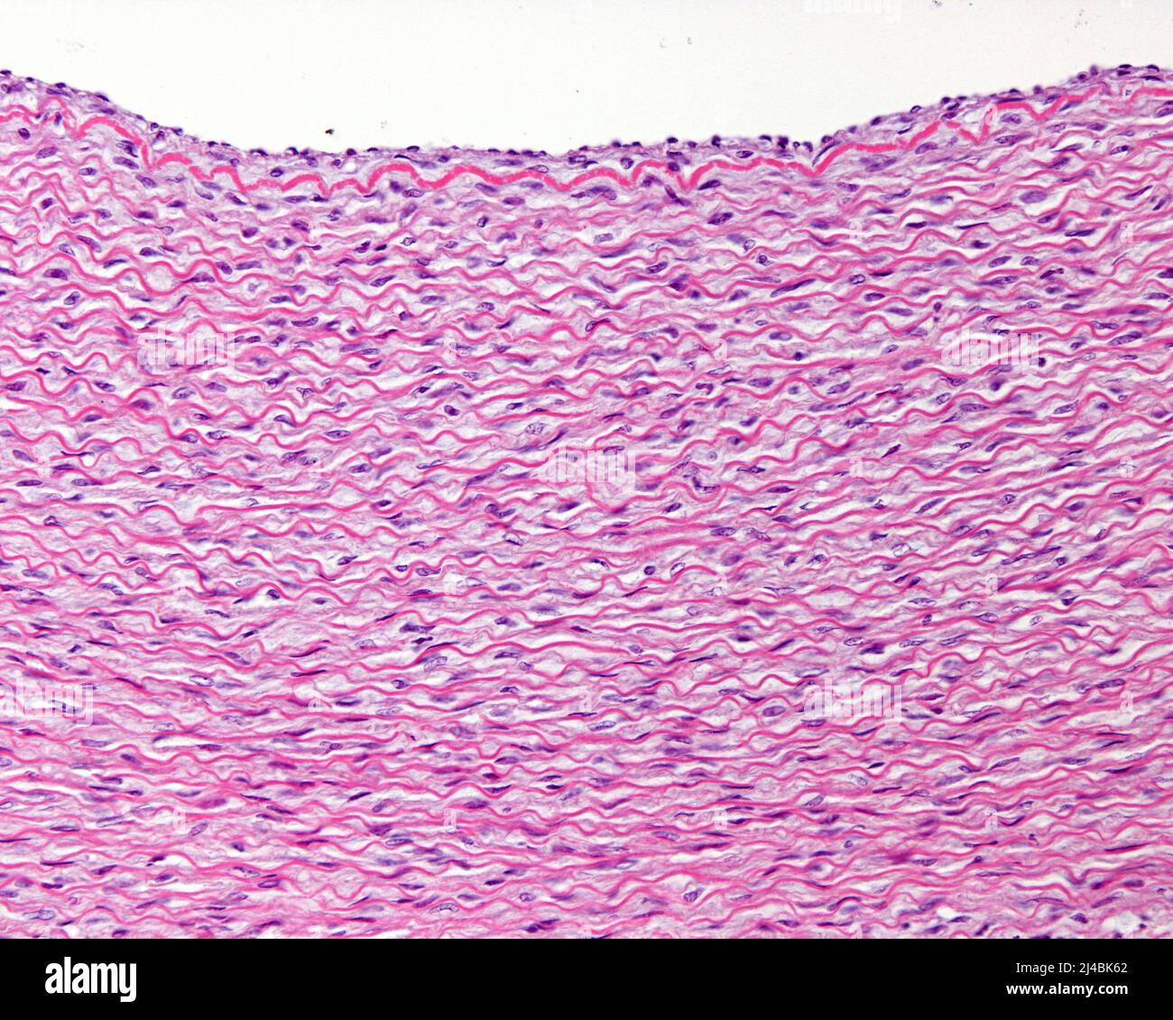 Elastic lamellae in human aorta, light micrograph Stock Photo - Alamy