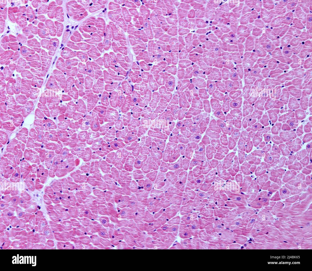 Heart myocardium, light micrograph Stock Photo - Alamy