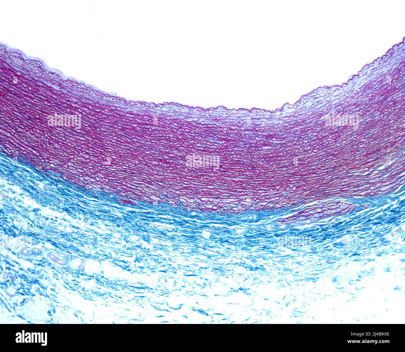 Human aorta, light micrograph Stock Photo - Alamy