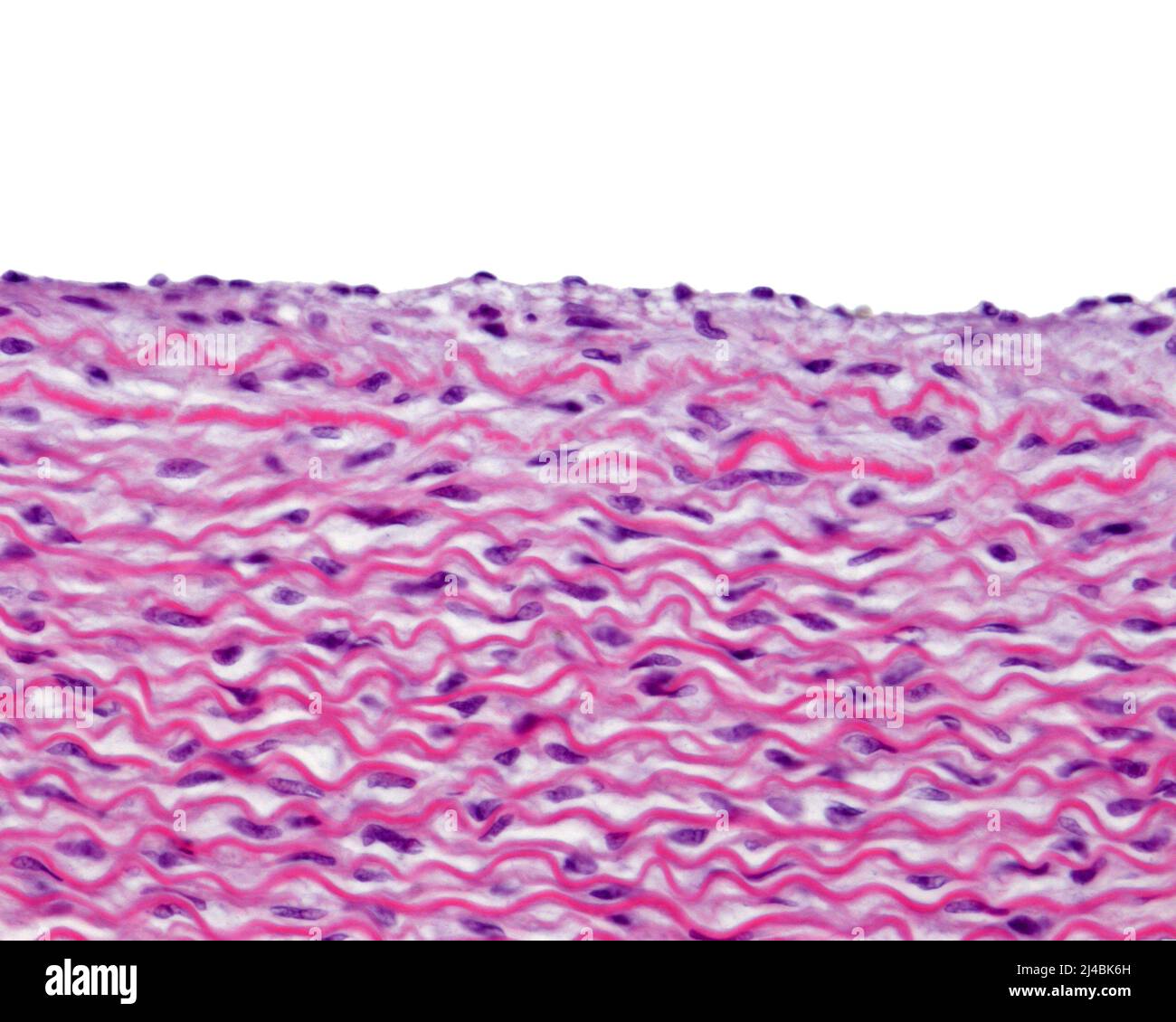 Elastic Connective Tissue Aorta
