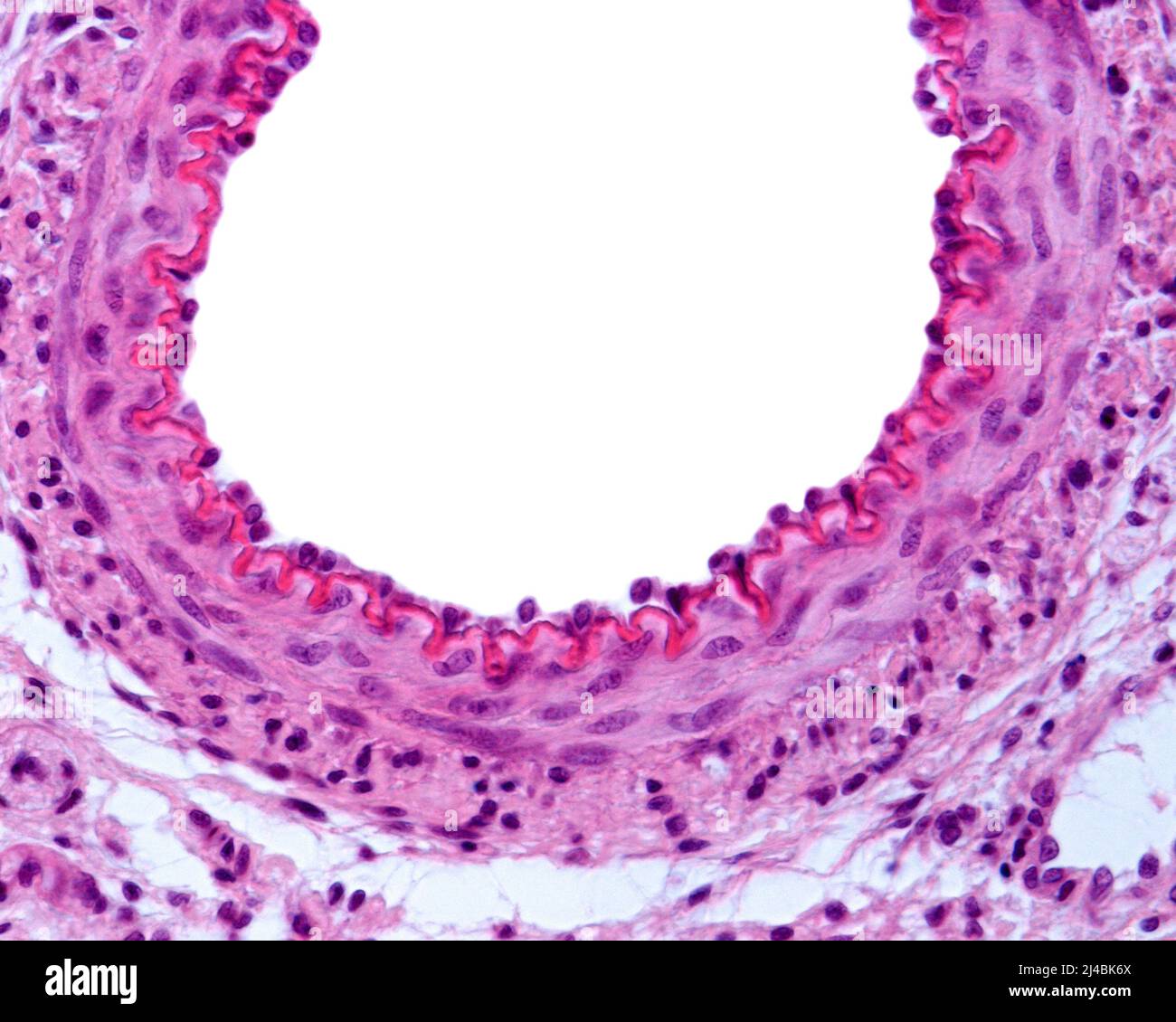 Muscular artery, light micrograph Stock Photo - Alamy