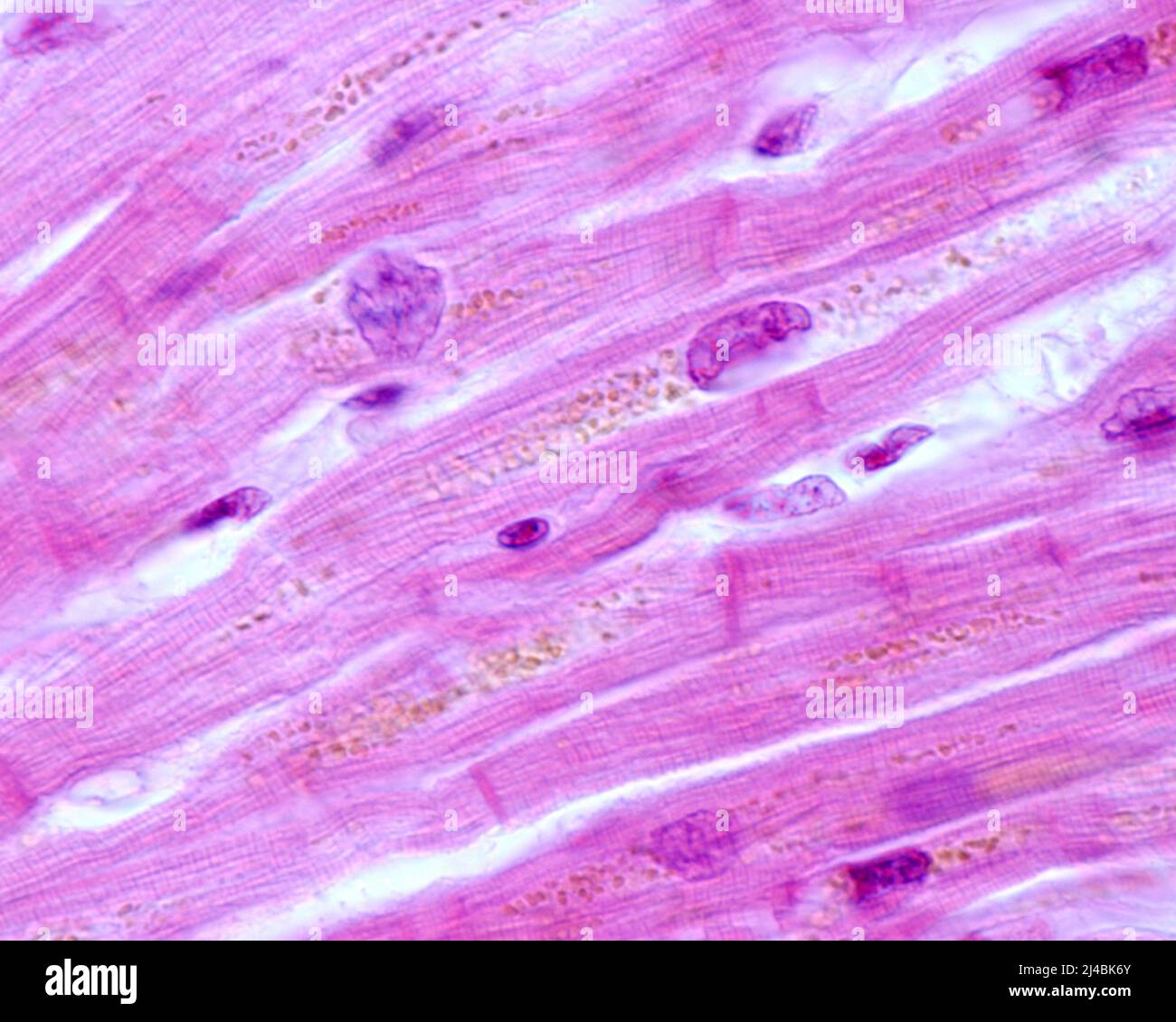 Lipofuscin in heart muscle cells, light micrograph Stock Photo - Alamy