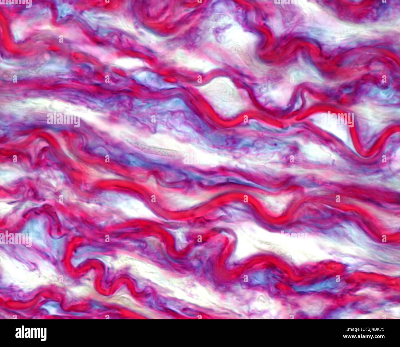 Elastic lamellae in aorta, light micrograph Stock Photo - Alamy