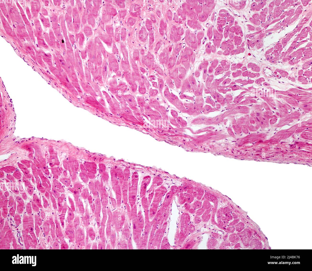 Human heart endocardium, light micrograph Stock Photo - Alamy