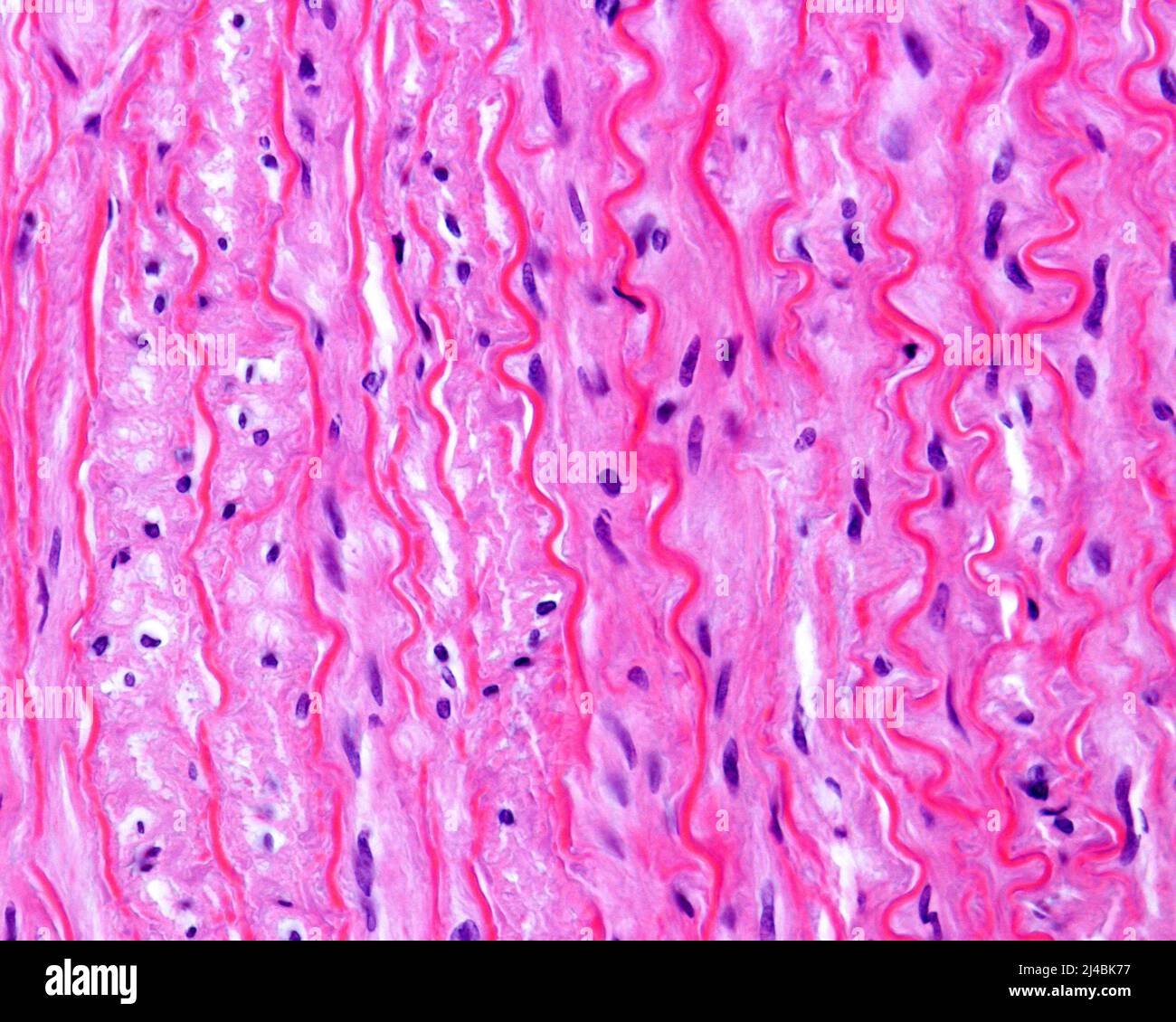 Elastic Connective Tissue Aorta