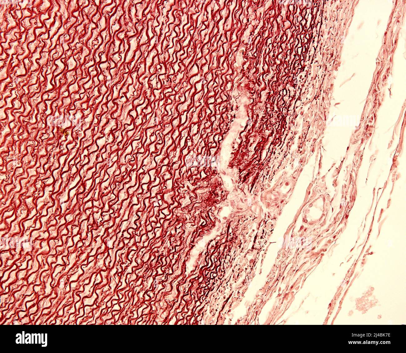 Human aorta, light micrograph Stock Photo - Alamy