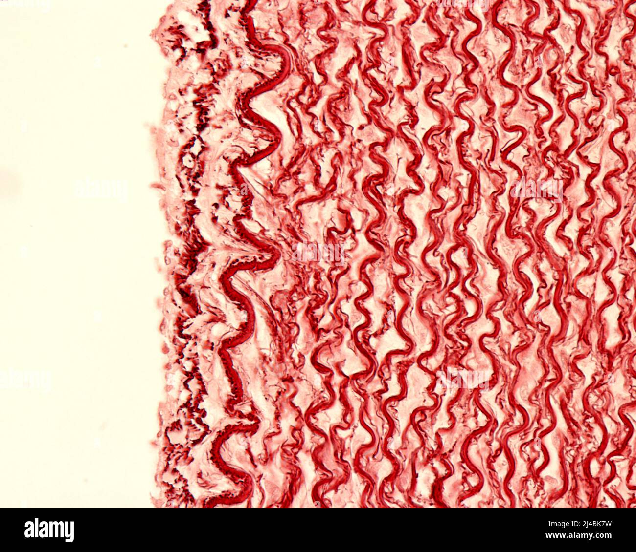 Human aorta, light micrograph Stock Photo - Alamy