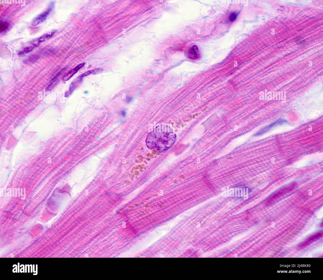 Lipofuscin in heart muscle cells, light micrograph Stock Photo - Alamy