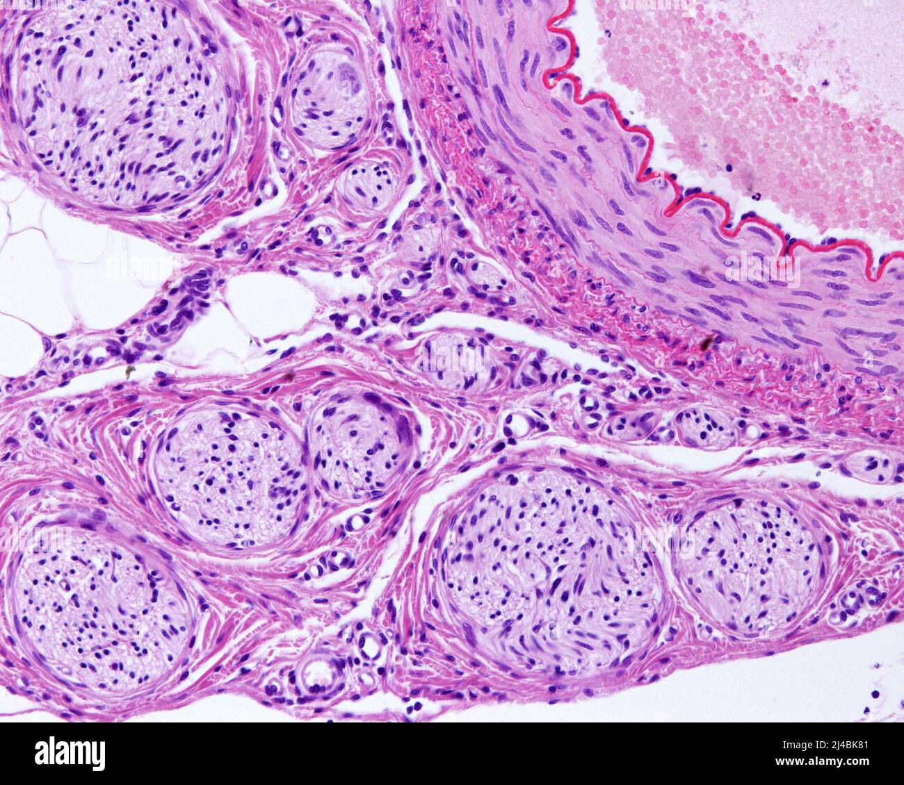 Nerve fibres and muscular artery, light micrograph Stock Photo - Alamy