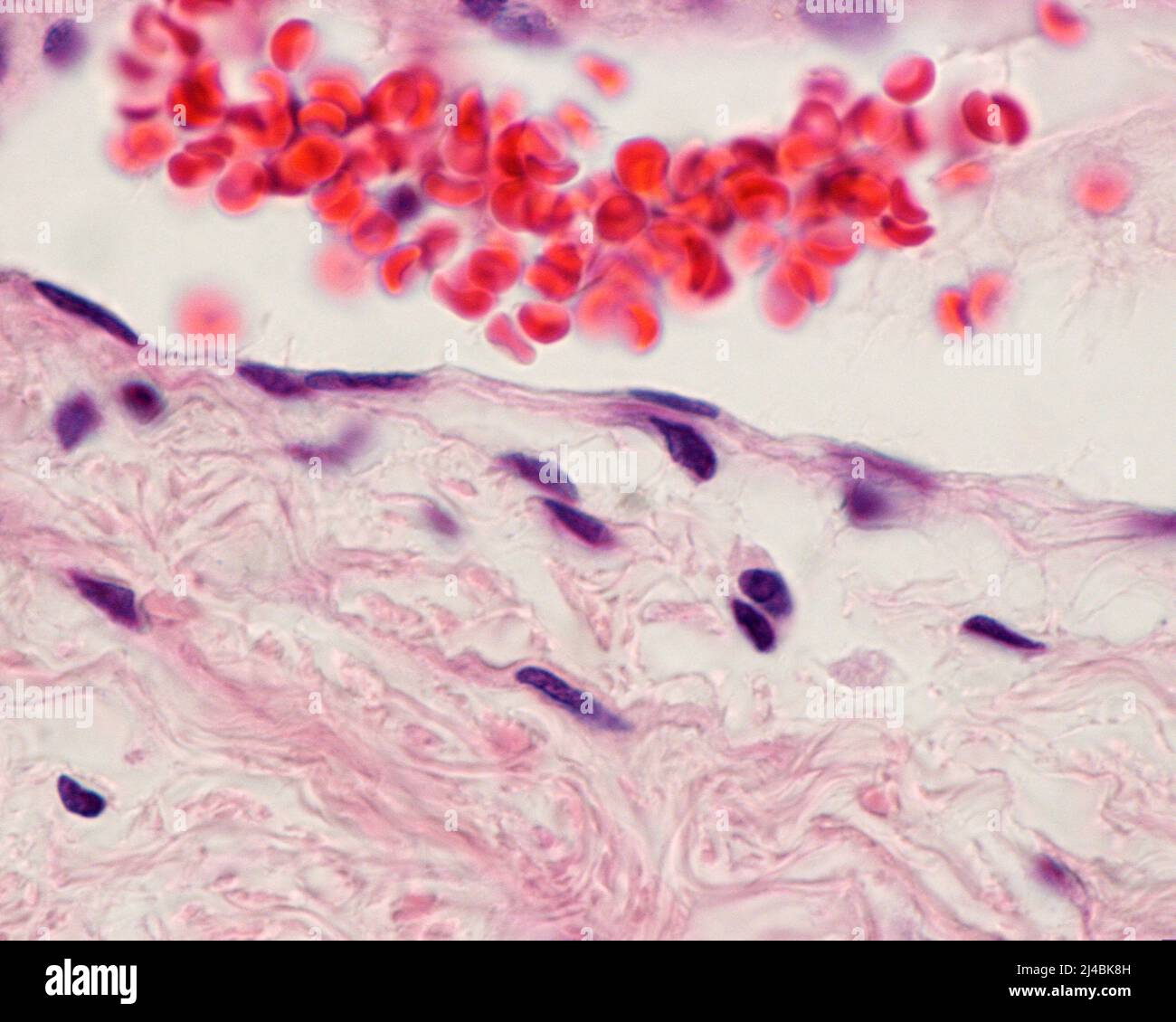 Venule, light micrograph Stock Photo - Alamy