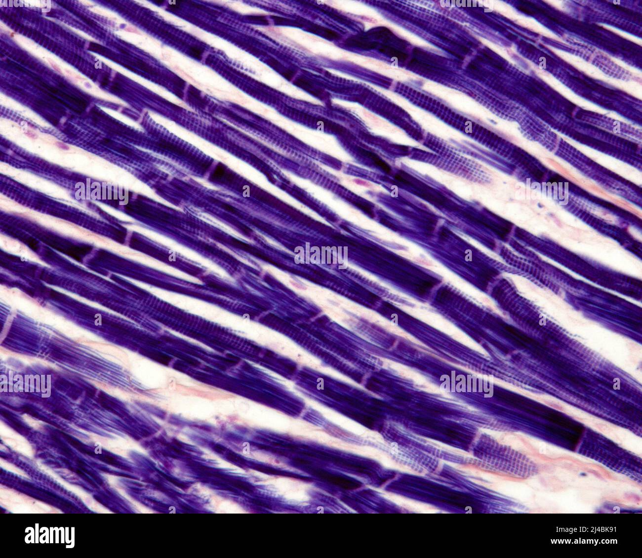 Heart myocardium, light micrograph Stock Photo - Alamy