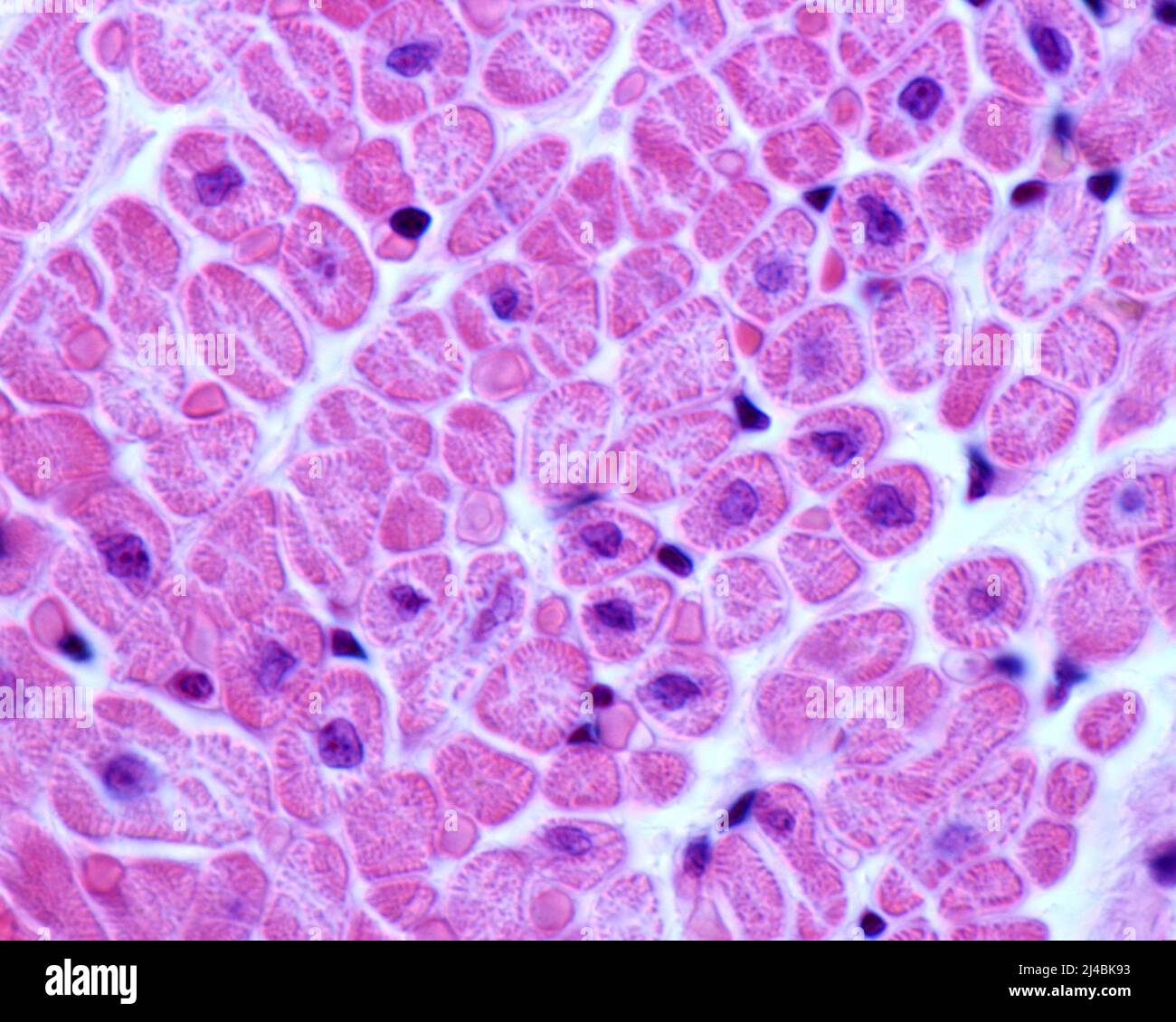 Heart myocardium, light micrograph Stock Photo - Alamy