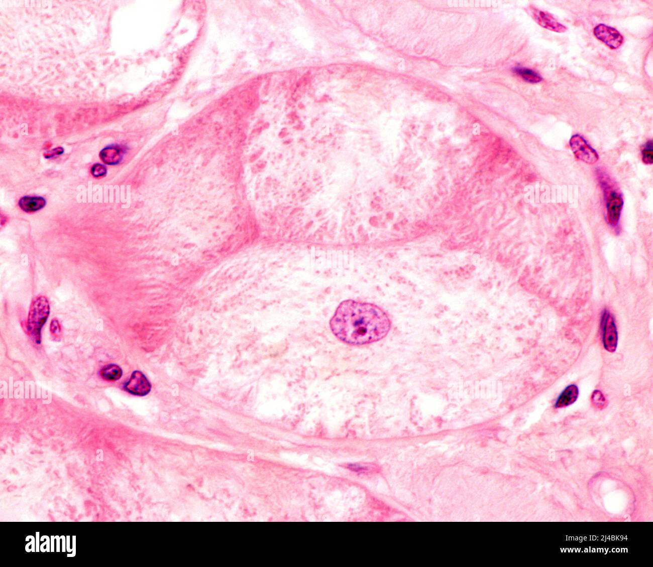 Heart. Purkinje fibre, light micrograph Stock Photo - Alamy