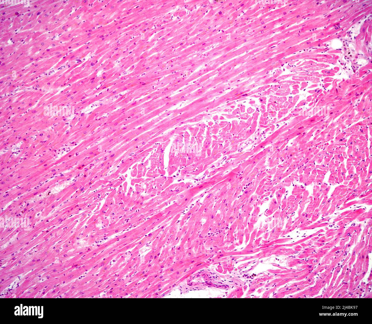 Heart myocardium, light micrograph Stock Photo - Alamy