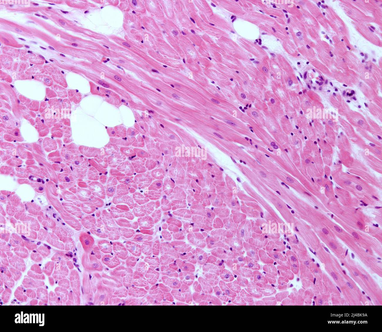 Heart myocardium, light micrograph Stock Photo - Alamy