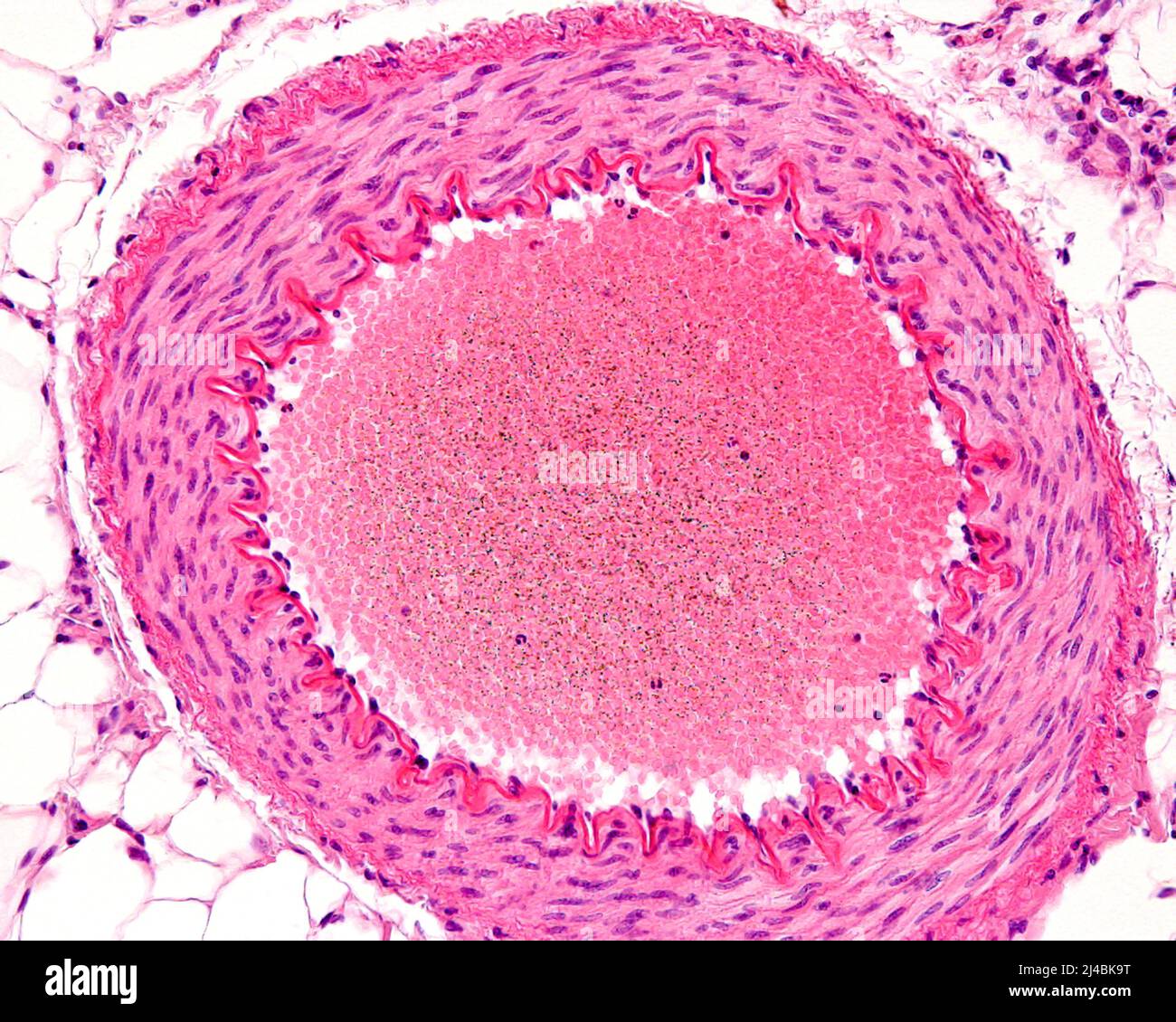 Muscular artery, light micrograph Stock Photo - Alamy