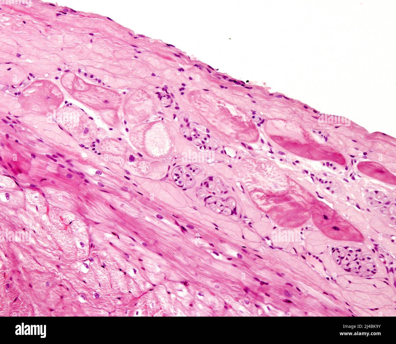Purkinje fibres in the heart, light micrograph Stock Photo - Alamy