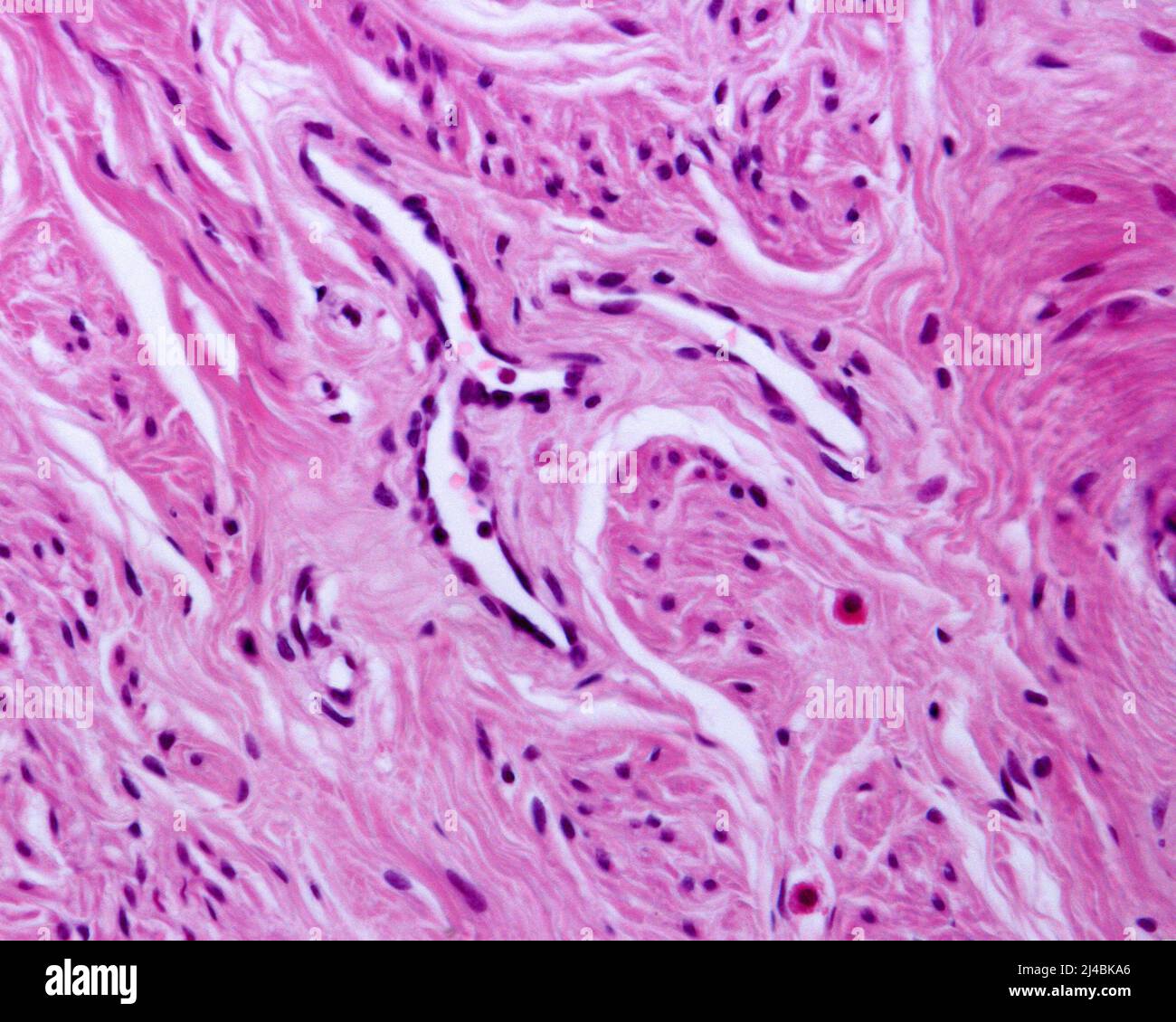 Blood vessels in connective tissue, light micrograph Stock Photo - Alamy