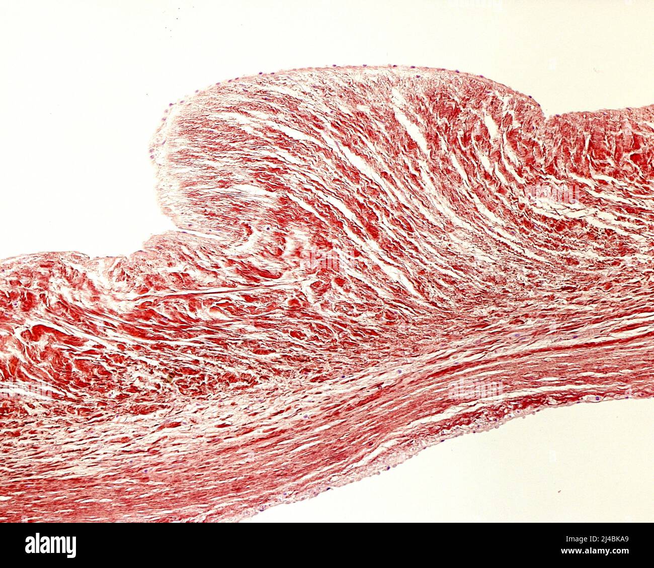 Heart valve, light micrograph Stock Photo - Alamy