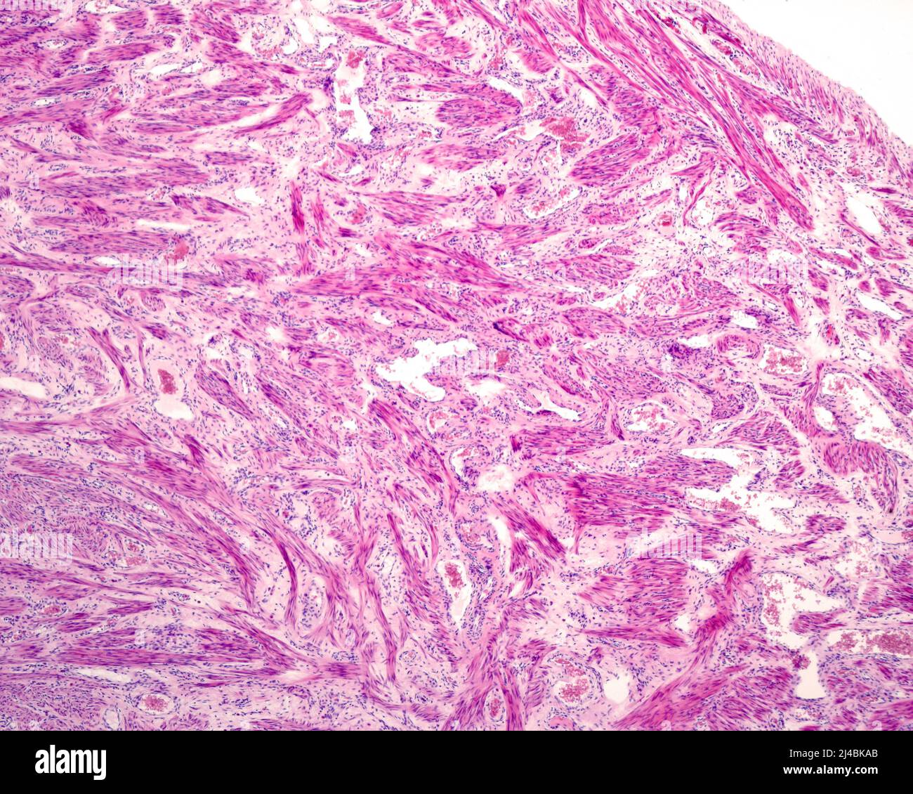 Smooth muscle fibres, light micrograph Stock Photo - Alamy