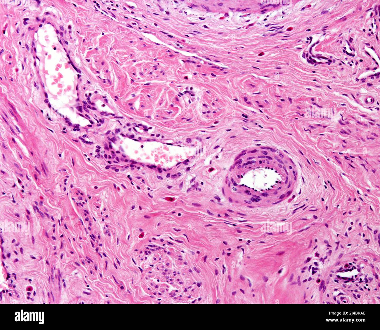 Blood Vessels In Connective Tissue Light Micrograph Stock Photo Alamy