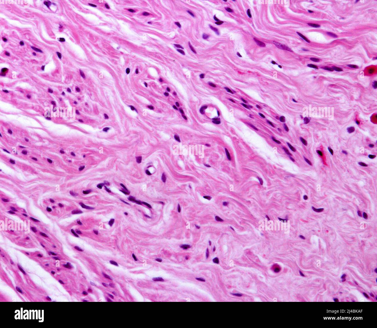 Blood vessels in connective tissue, light micrograph Stock Photo - Alamy
