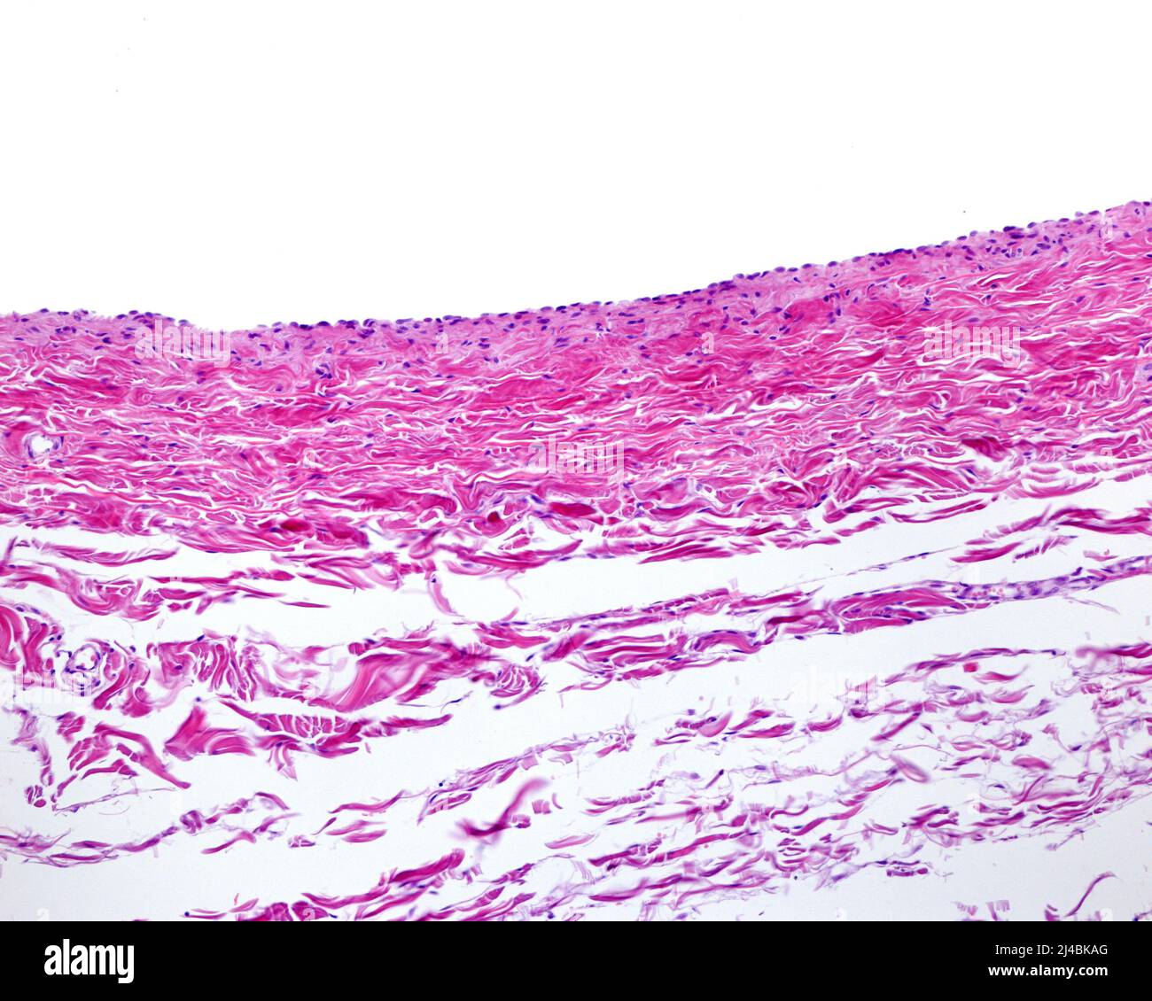 Large vein, light micrograph Stock Photo - Alamy