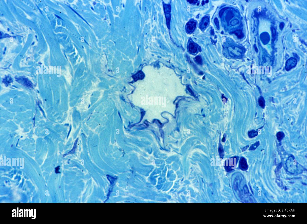 Lymphatic capillary, light micrograph Stock Photo - Alamy